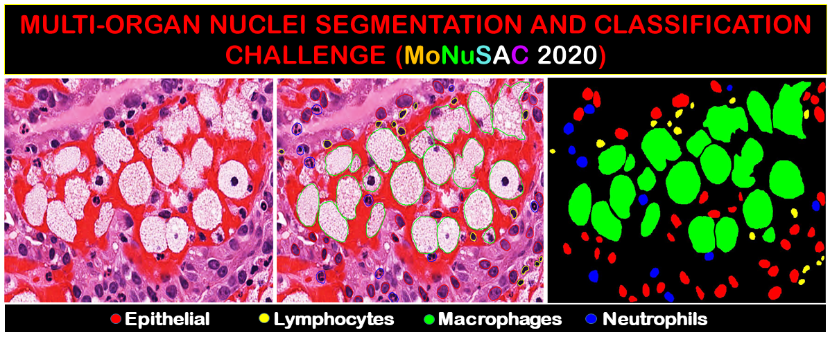 MoNuSAC2020: A Multi-Organ Nuclei Segmentation and Classification ... MoNuSAC2020: A Multi-Organ Nuclei Segmentation and Classification ...